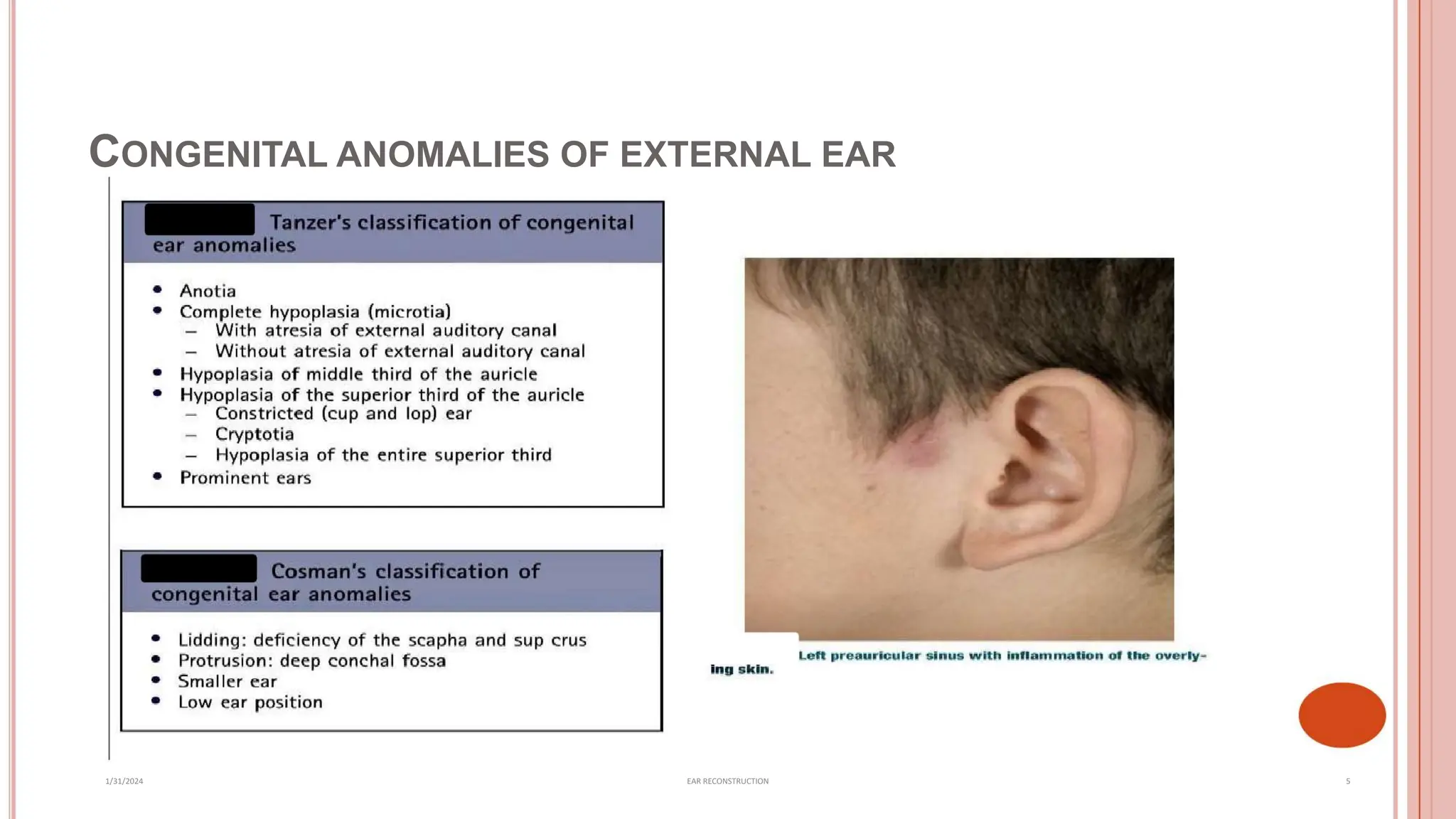 the ear structure.ppt
