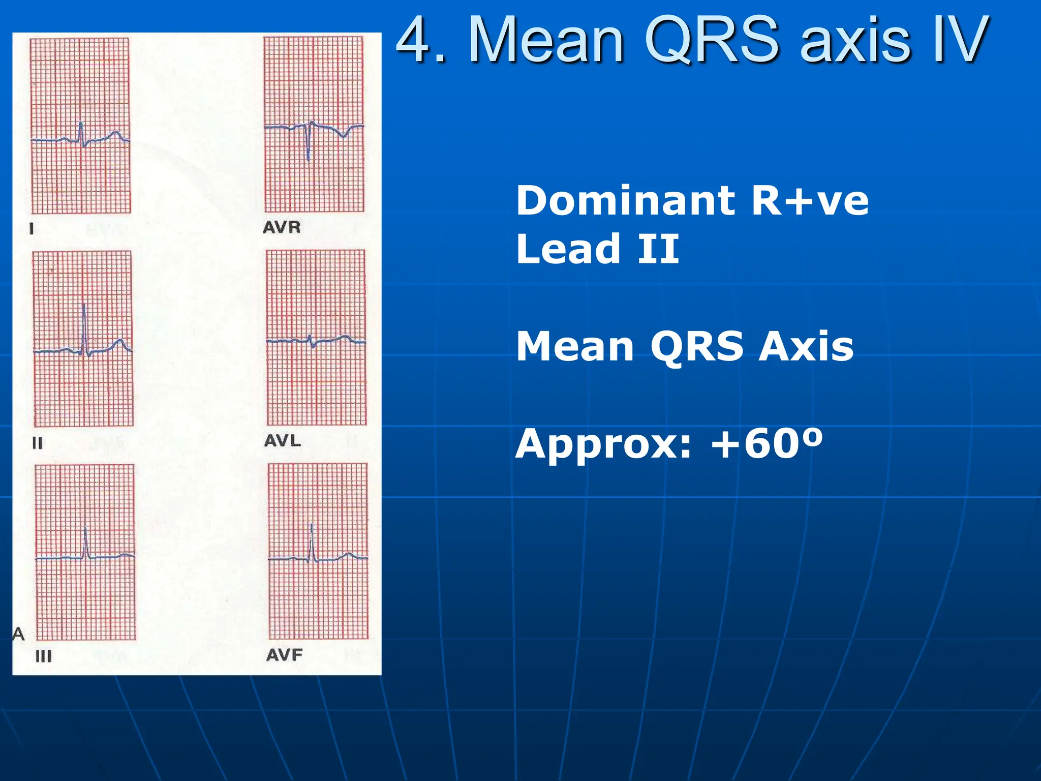 The ECG - lecture.ppt for medical students | PPT