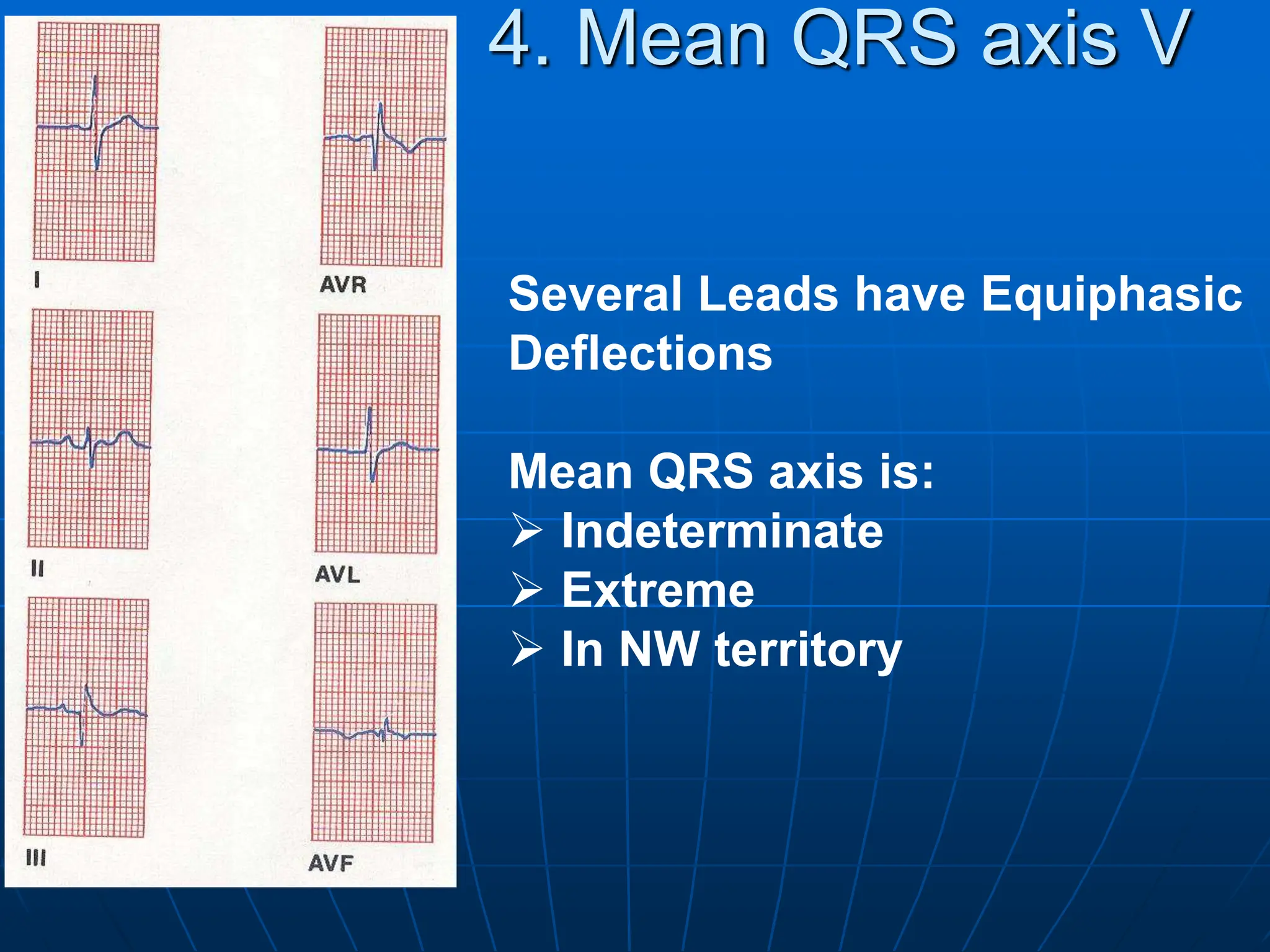The ECG - lecture.ppt for medical students | PPT