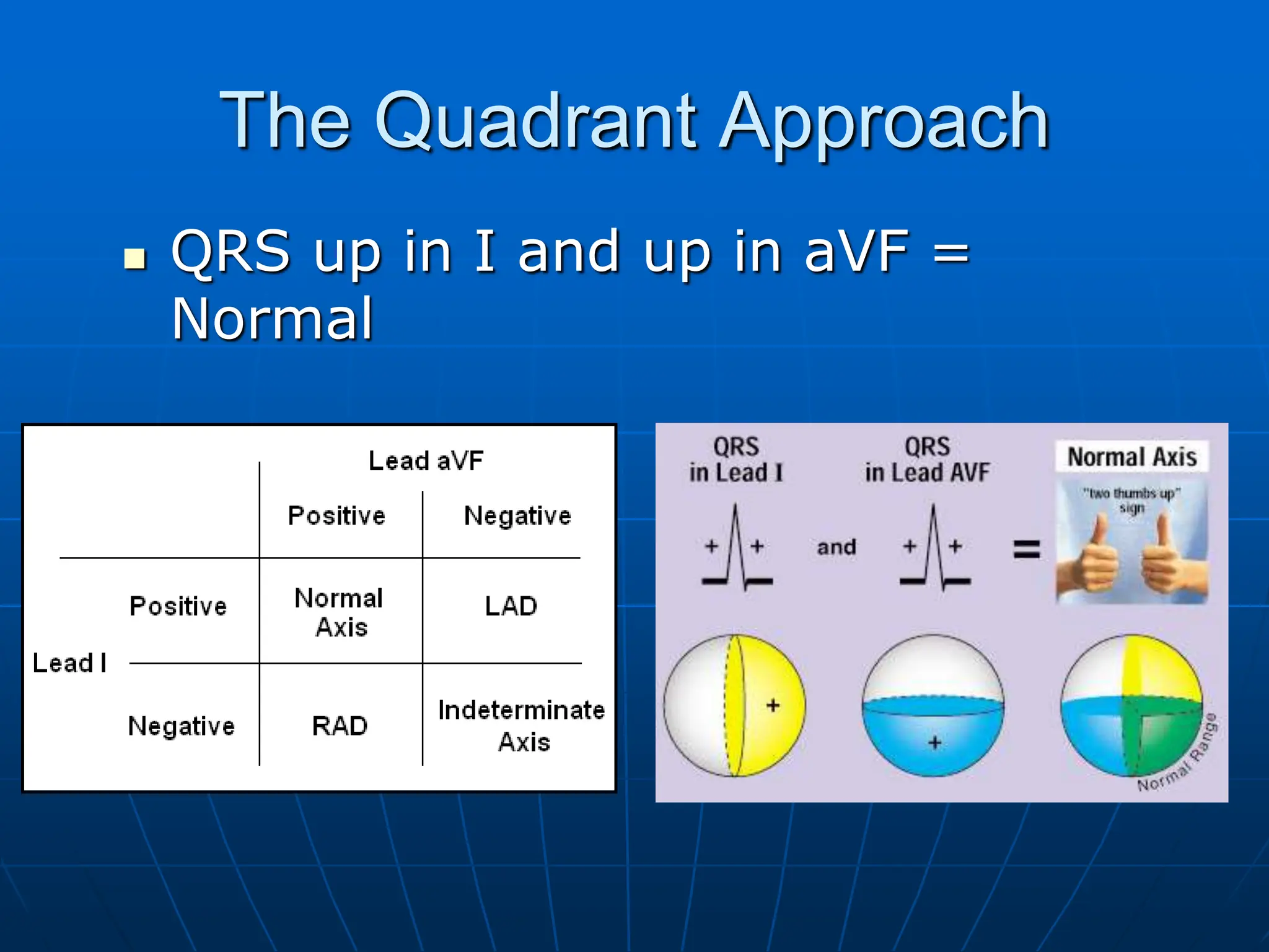 The ECG - lecture.ppt for medical students | PPT