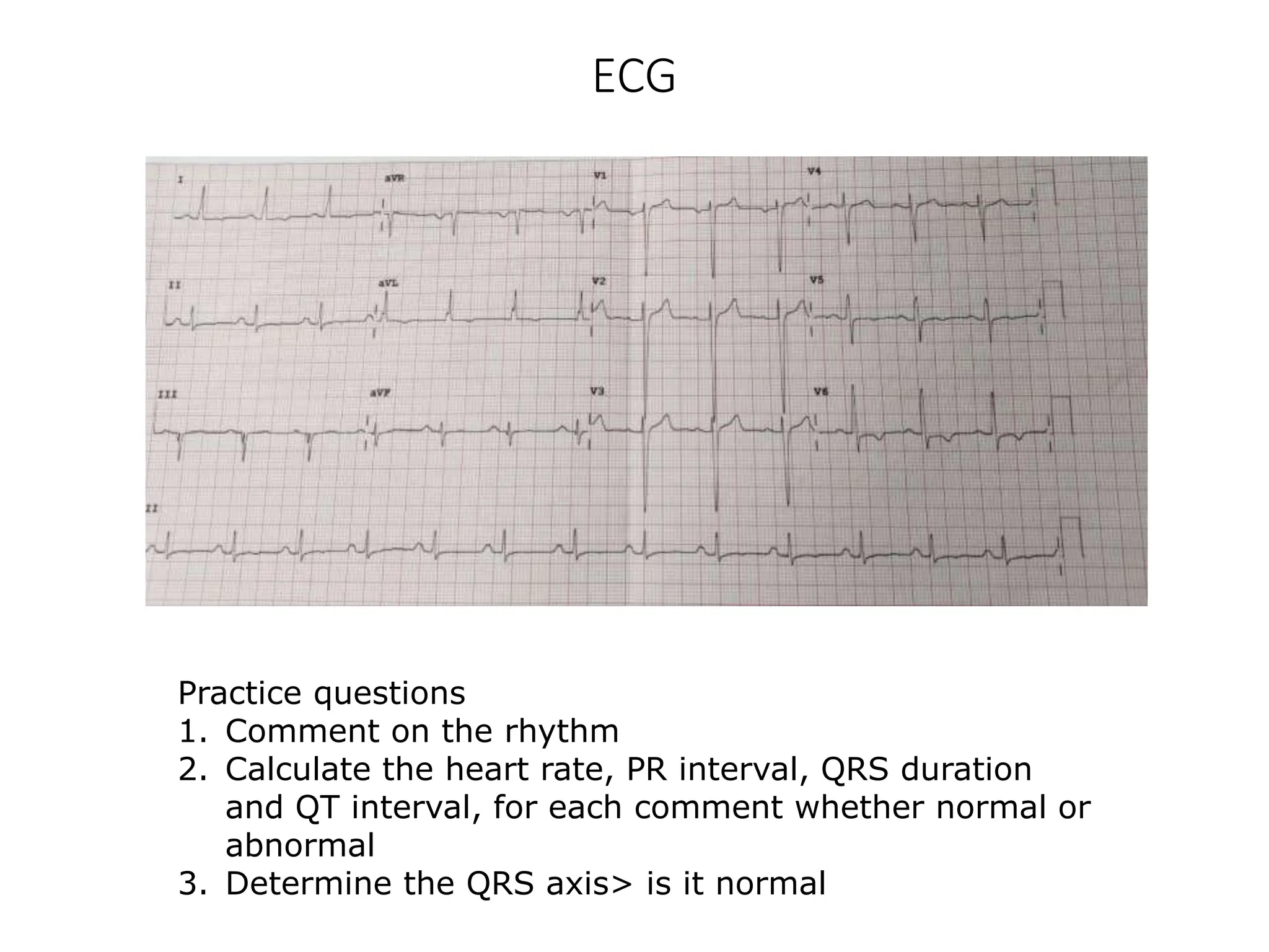 The ECG - lecture.ppt for medical students | PPT