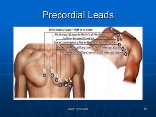 The ECG - lecture.ppt for medical students | PPT