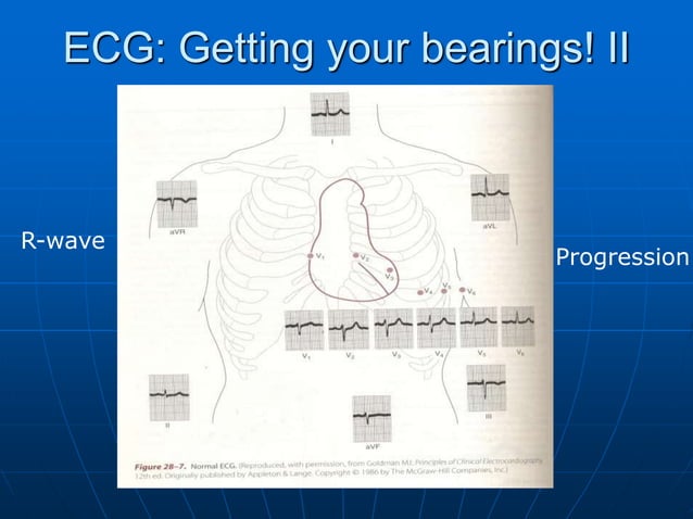 The ECG - lecture.ppt for medical students | PPT | Heart and ...