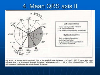The ECG - lecture.ppt for medical students | PPT