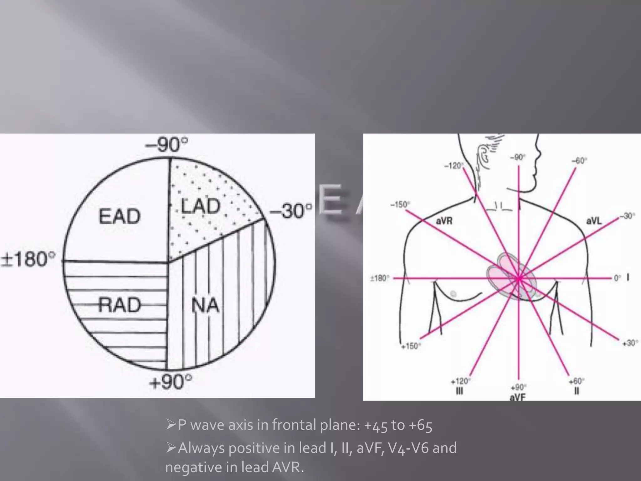 The ecg in chmaber enlargement approach | PPTX