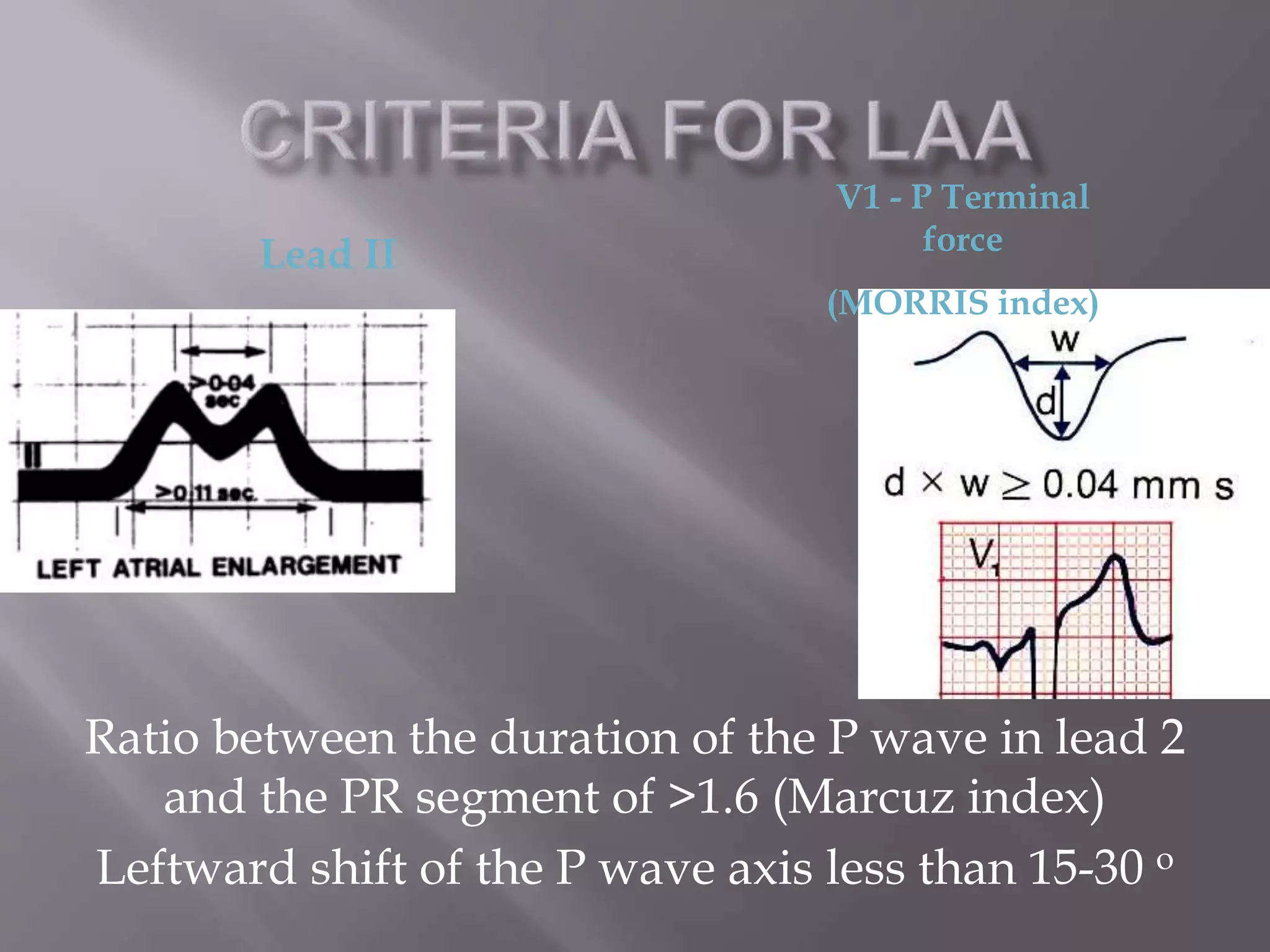 The ecg in chmaber enlargement approach | PPTX
