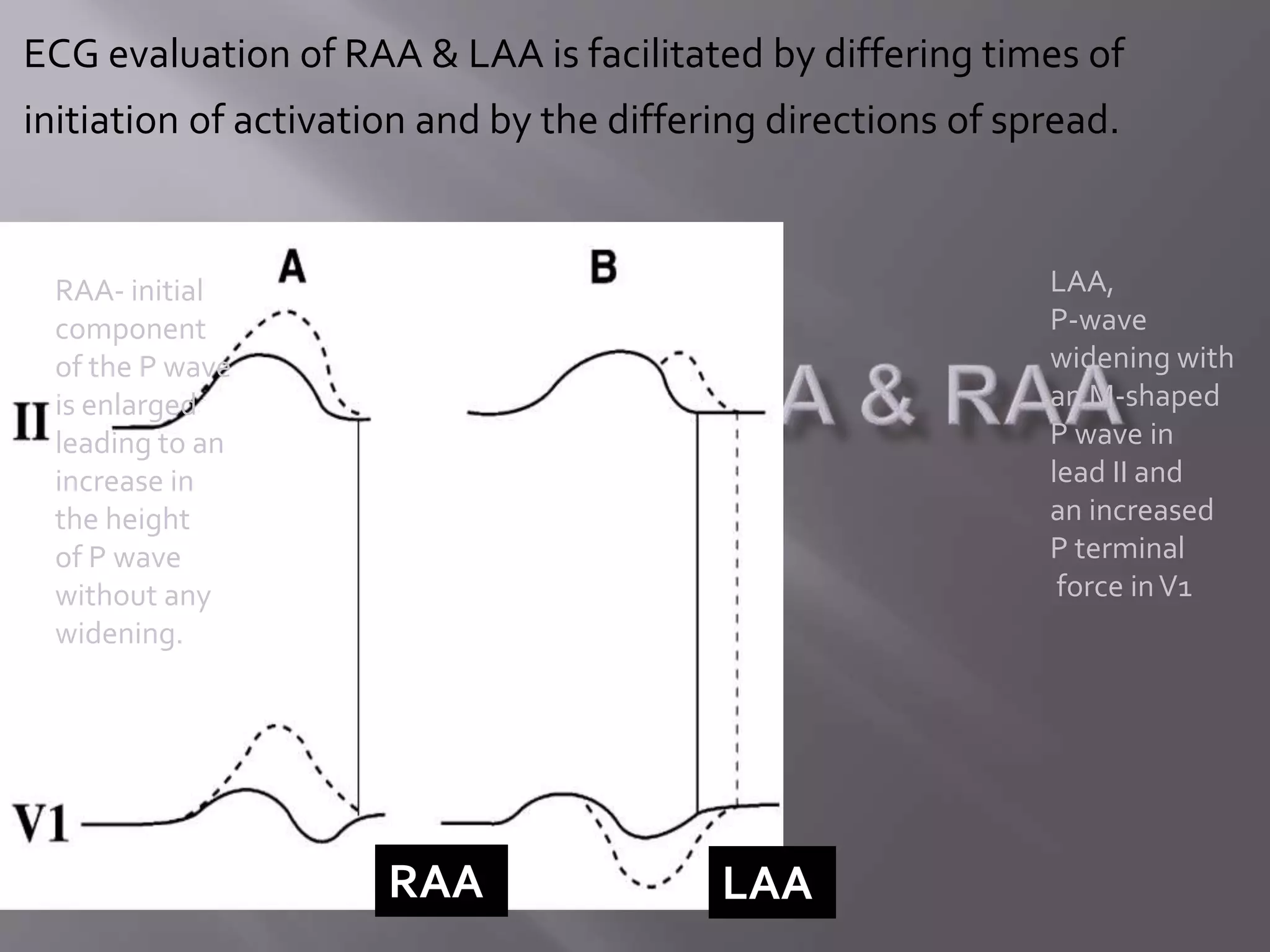 The ecg in chmaber enlargement approach | PPTX