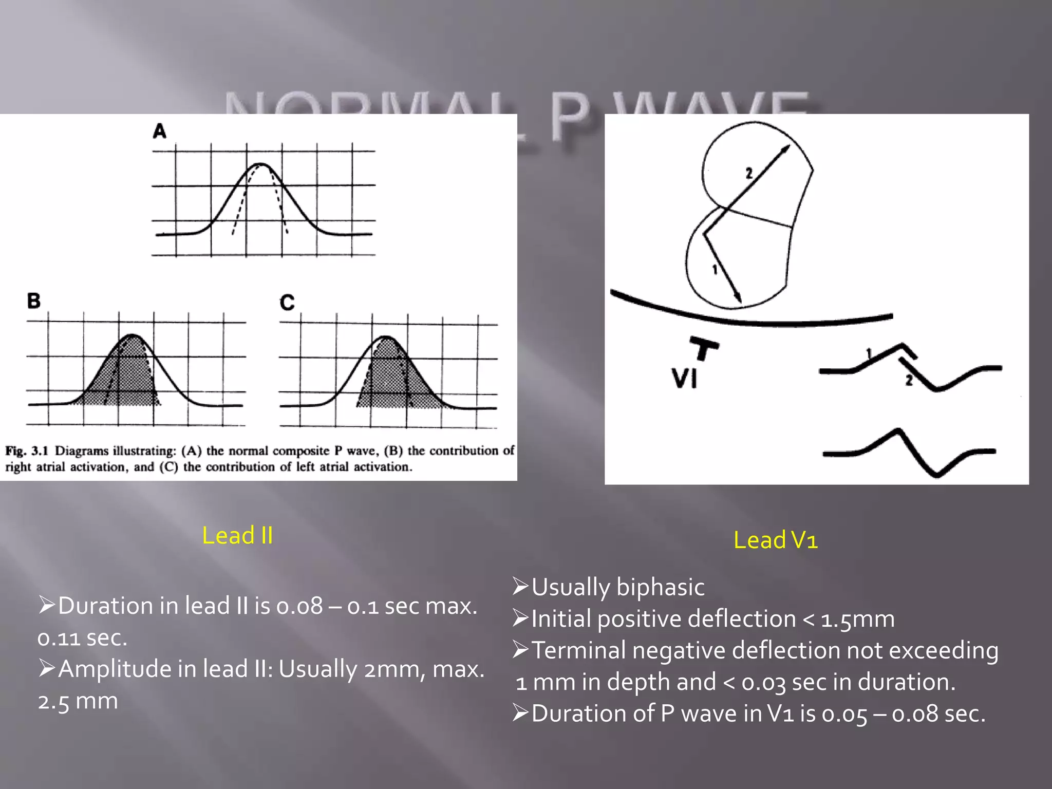 The ecg in chmaber enlargement approach | PPTX