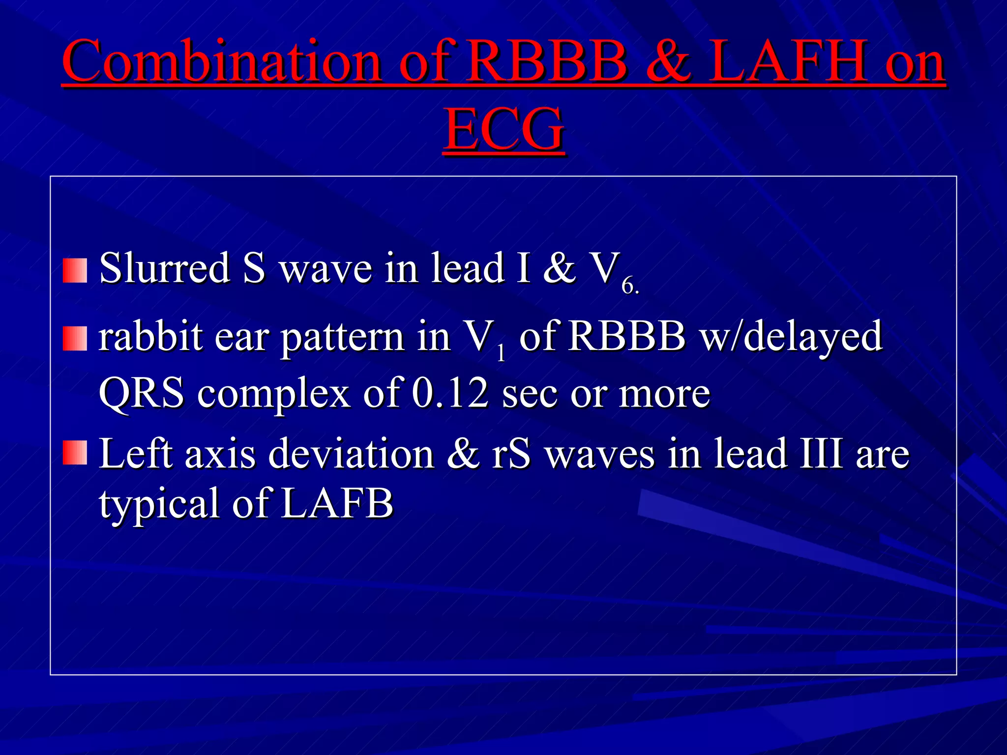 ECG: RBBB with LAFB | PPT