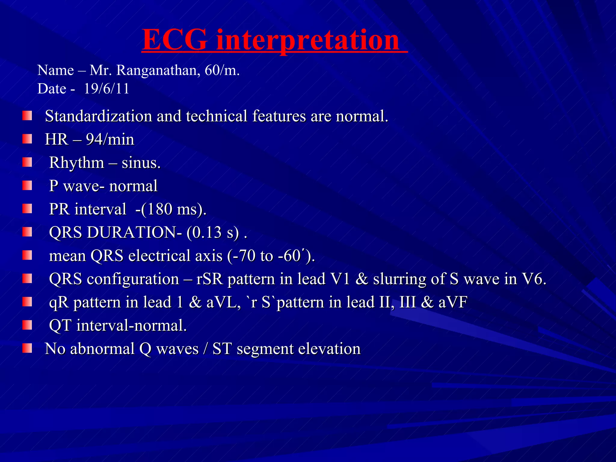 ECG: RBBB with LAFB | PPT