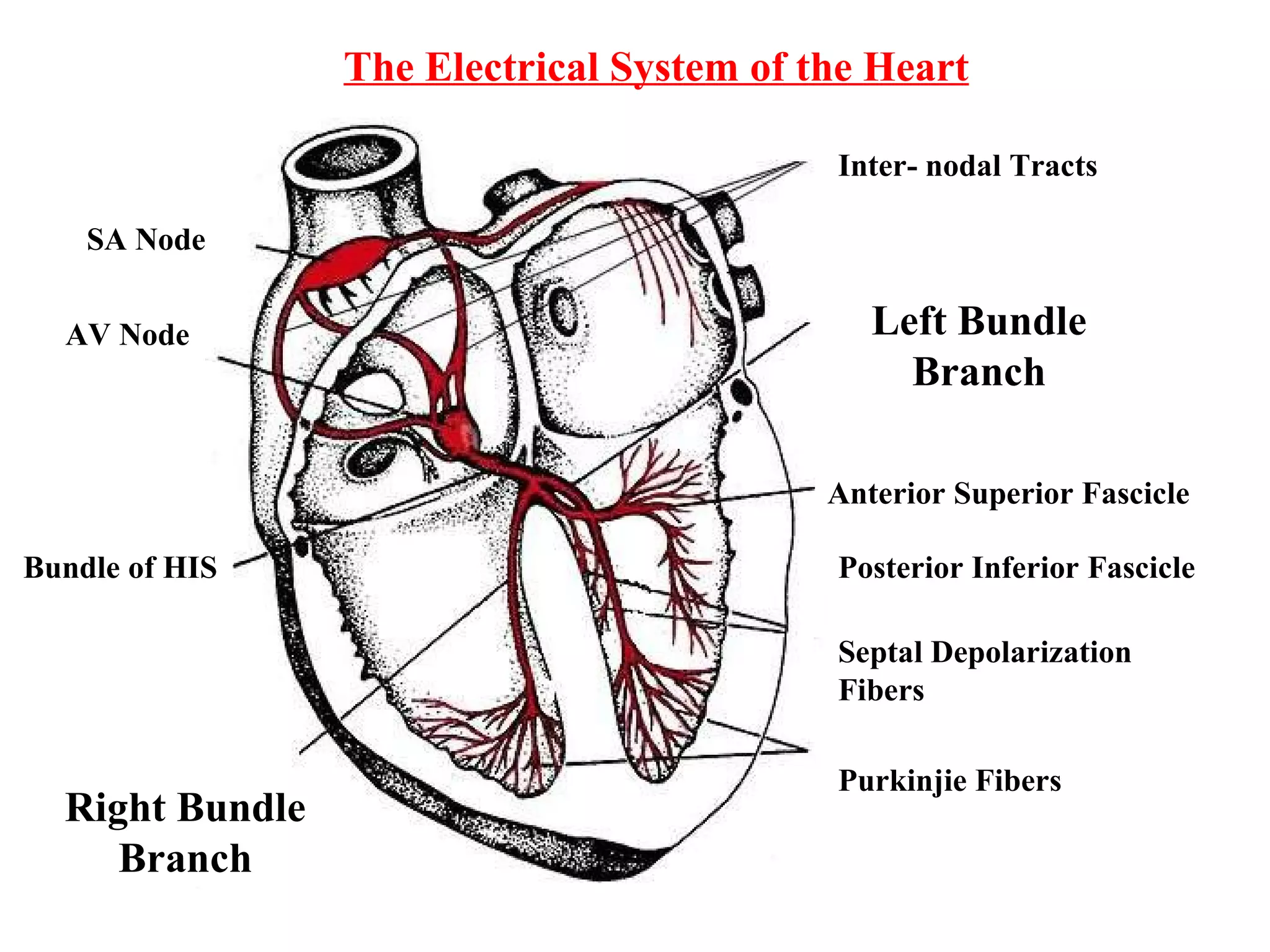 ECG: RBBB with LAFB | PPT | Free Download