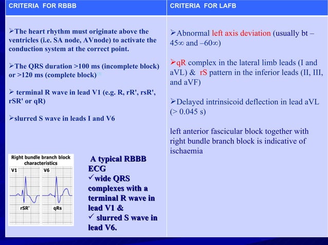 ECG: RBBB with LAFB | PPT