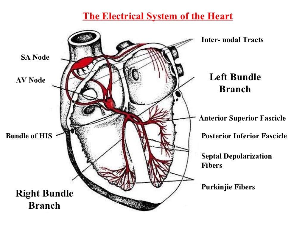 ECG: RBBB with LAFB