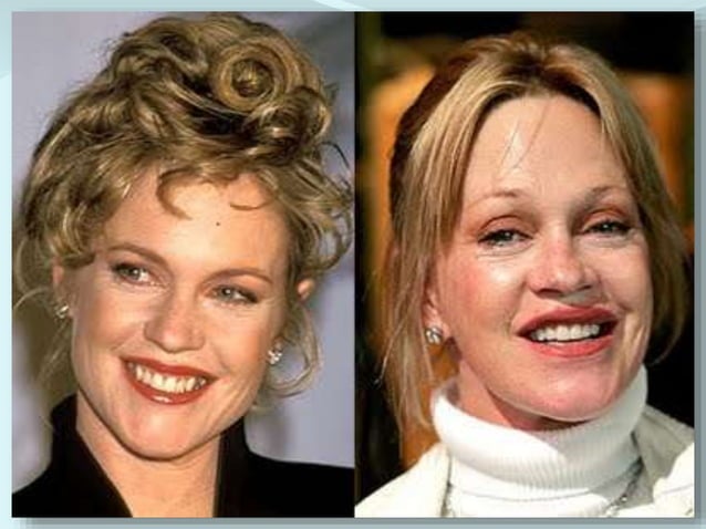 The effect of plastic surgery on woman’s beauty | PPT