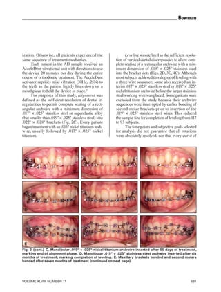 The effect of vibration on the rate of leveling and alignment | PDF