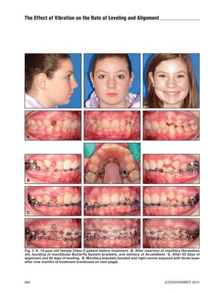 The effect of vibration on the rate of leveling and alignment | PDF