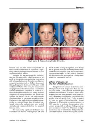 The effect of vibration on the rate of leveling and alignment | PDF