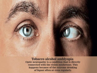 The effects that alcohol can have on our eyes | PDF