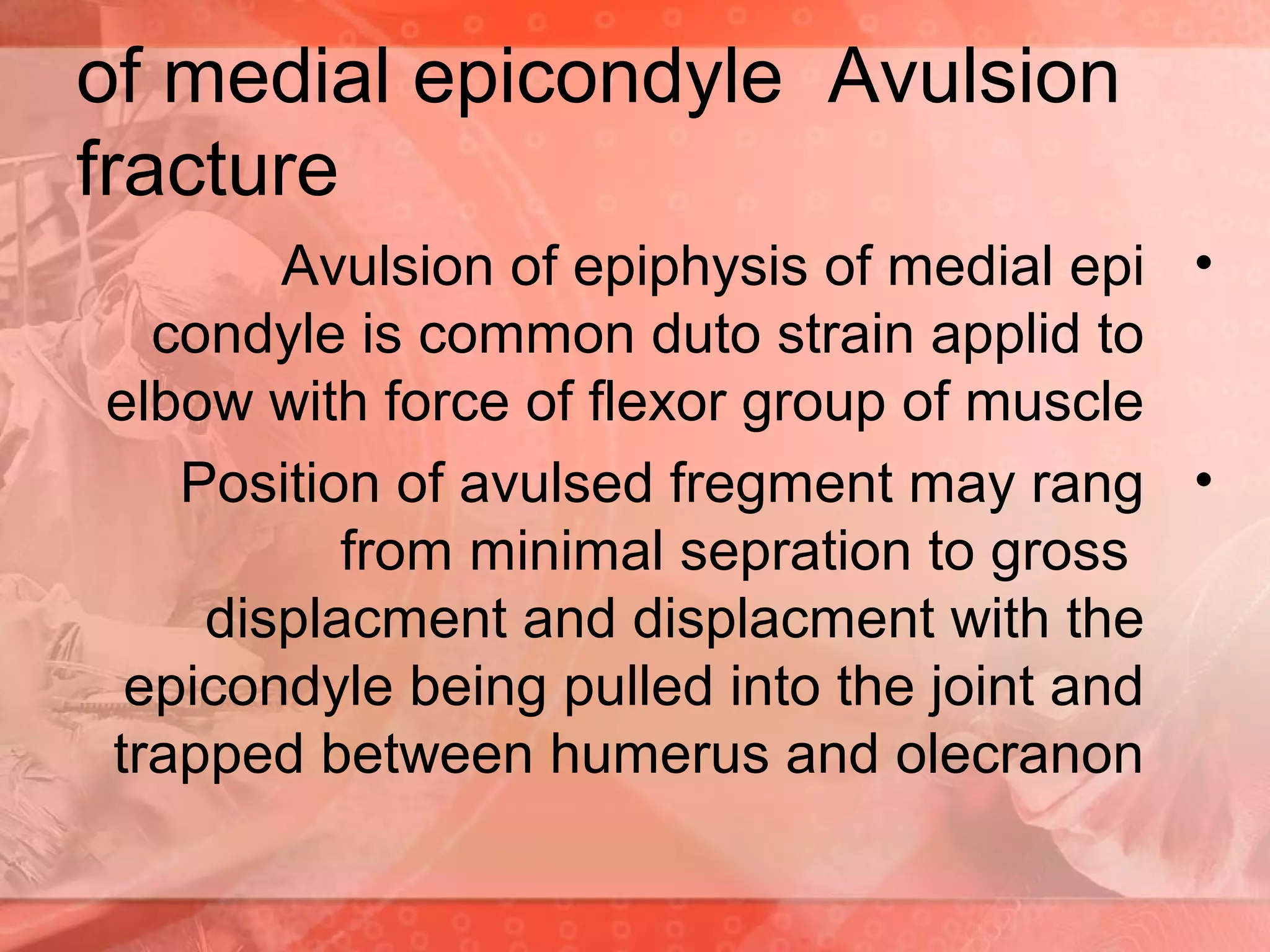 The elbow fracture | PPT
