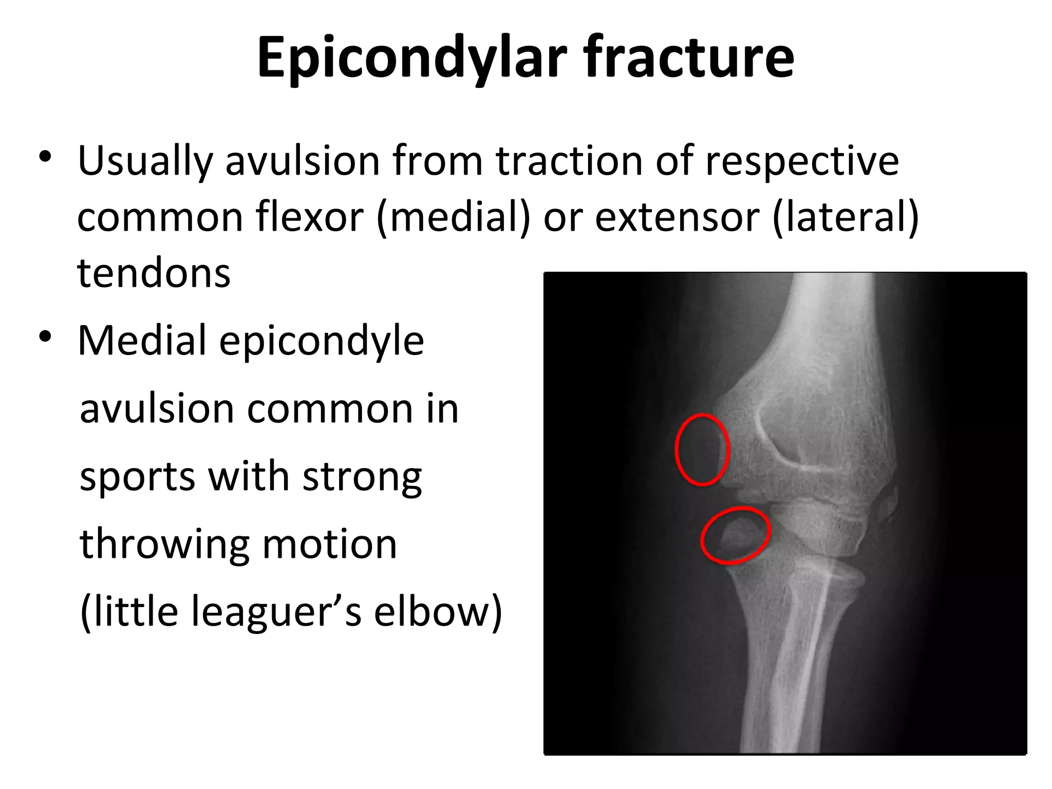 Radiology of the Elbow Joint. Dr. Sumit Sharma | PPT