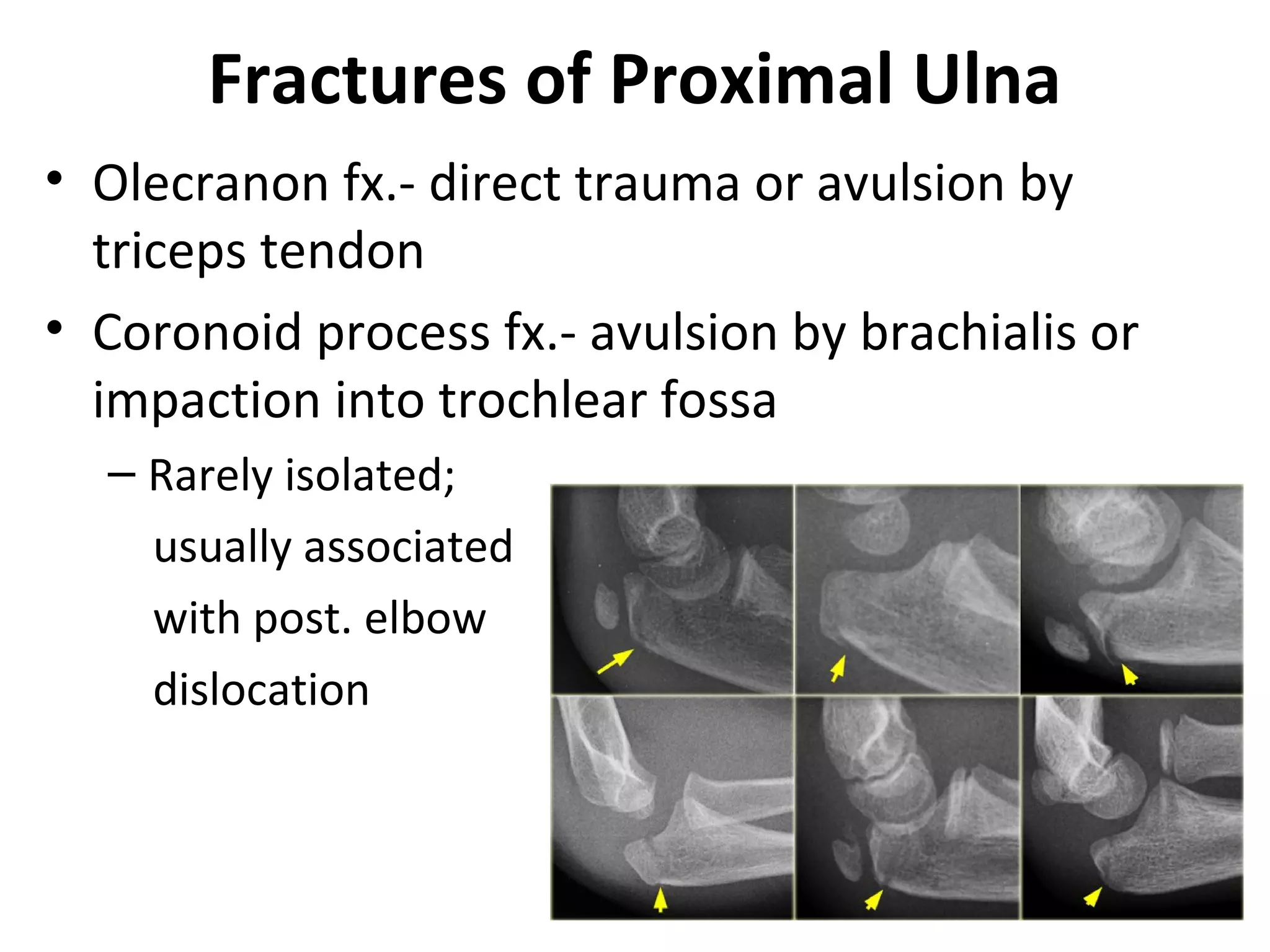 Radiology of the Elbow Joint. Dr. Sumit Sharma | PPT