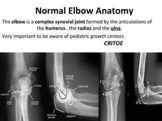 Elbow Anatomy Xray