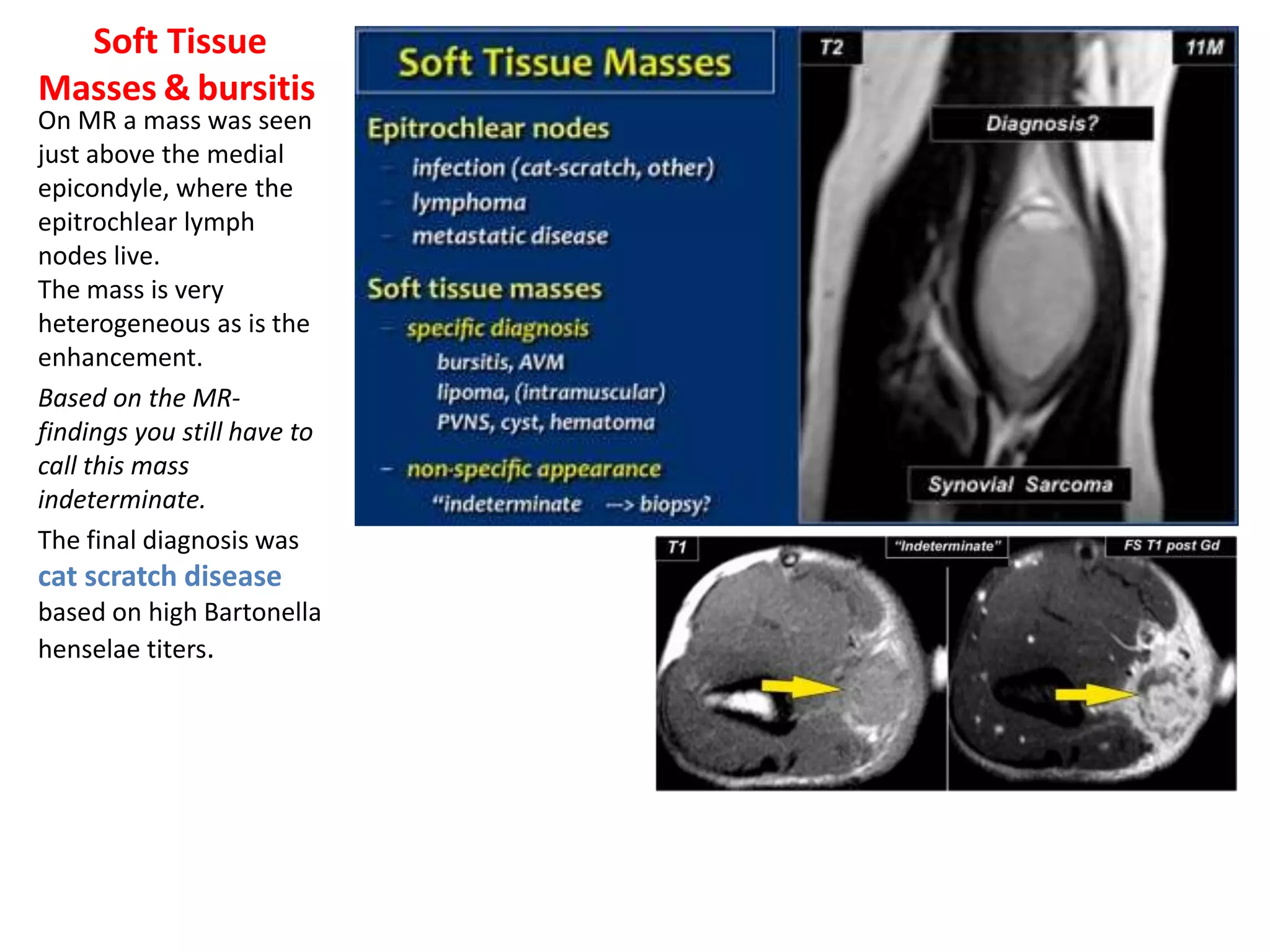 The elbow joint in concern of diagnostic imaging .pptx 1 | PPTX