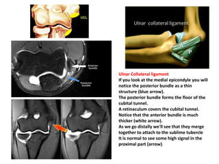 The elbow joint in concern of diagnostic imaging .pptx 1 | PPTX