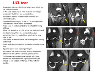 The elbow joint in concern of diagnostic imaging .pptx 1 | PPTX