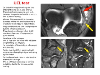 The elbow joint in concern of diagnostic imaging .pptx 1 | PPTX
