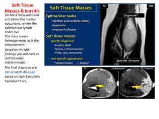 The elbow joint in concern of diagnostic imaging .pptx 1 | PPTX