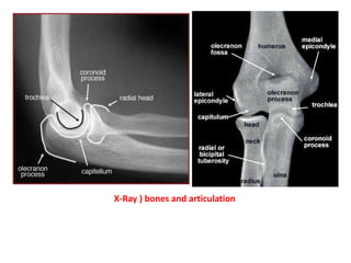 Elbow Joint X Ray