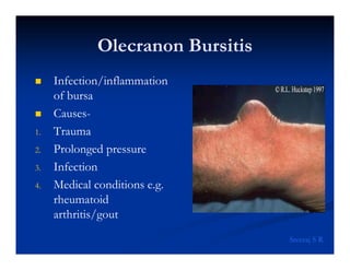 Olecranon Process Palpation