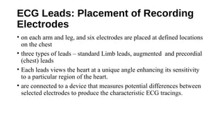 The electrocardiogram (ecg) | PPT