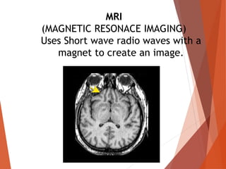Electromagnetic waves and the electromagnetic spectrum | PPT