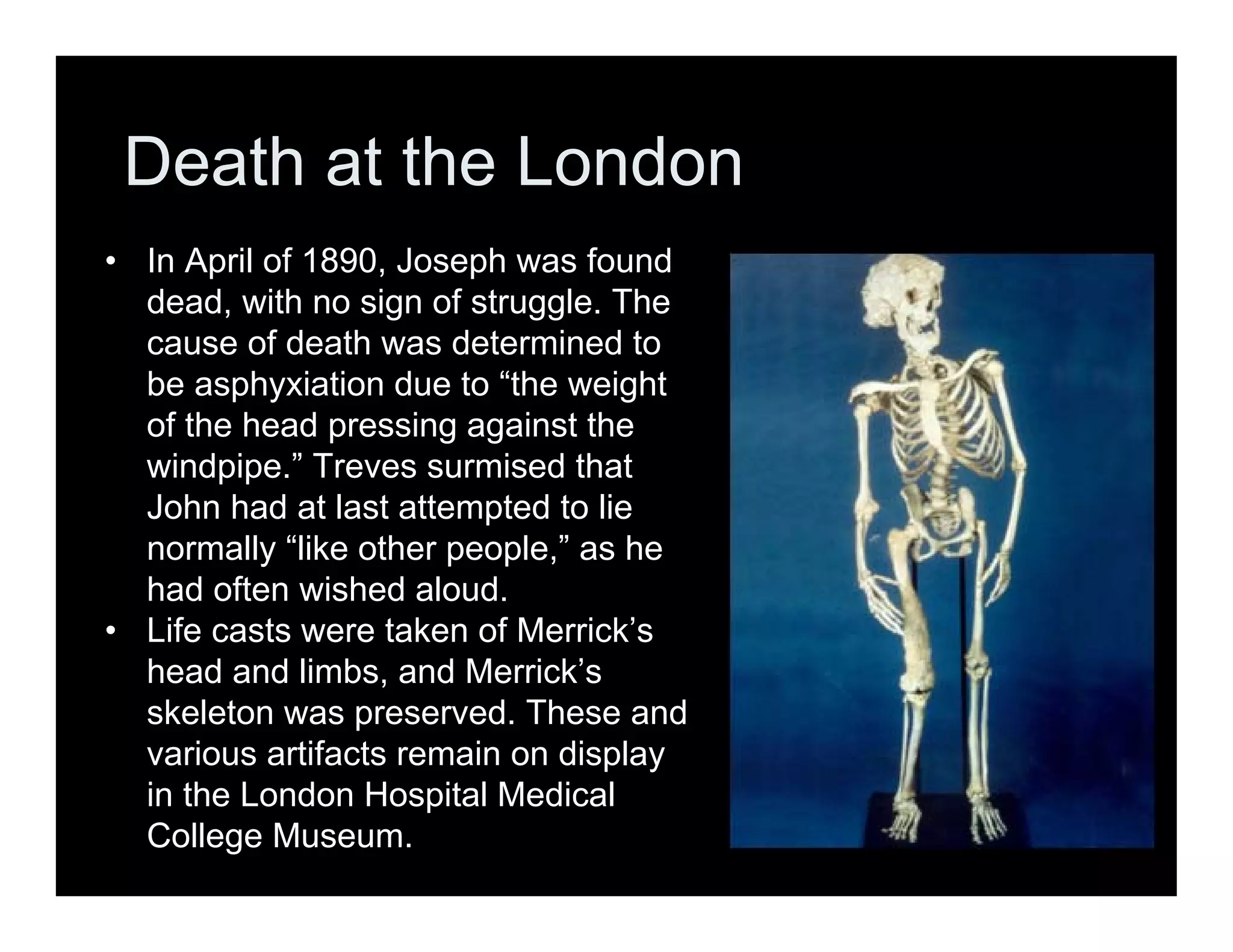 The elephant man (the real story)real | PDF