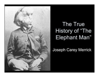 The elephant man (the real story)real | PPT