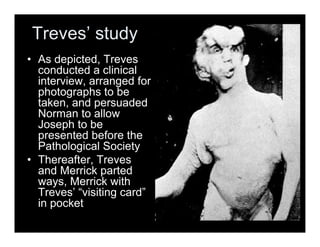 The elephant man (the real story)real | PPT