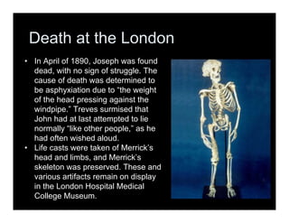 The elephant man (the real story)real | PPT