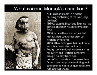 The elephant man (the real story)real | PPT