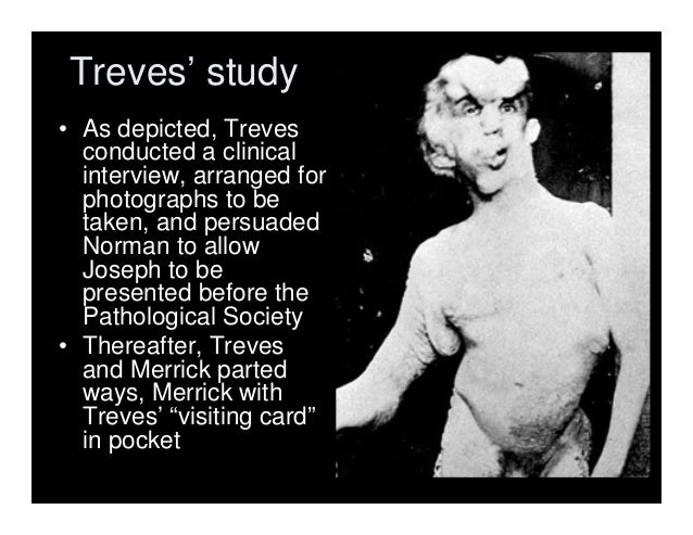 The elephant man (the real story)real