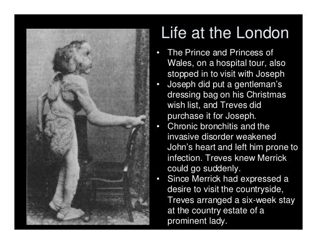 The elephant man (the real story)real