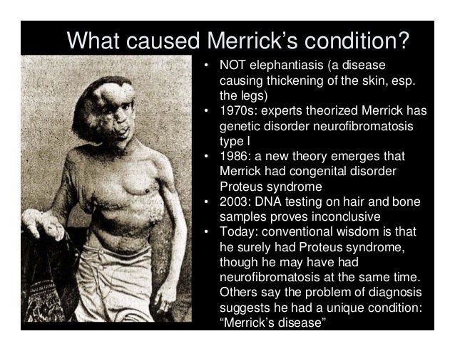 The elephant man (the real story)real