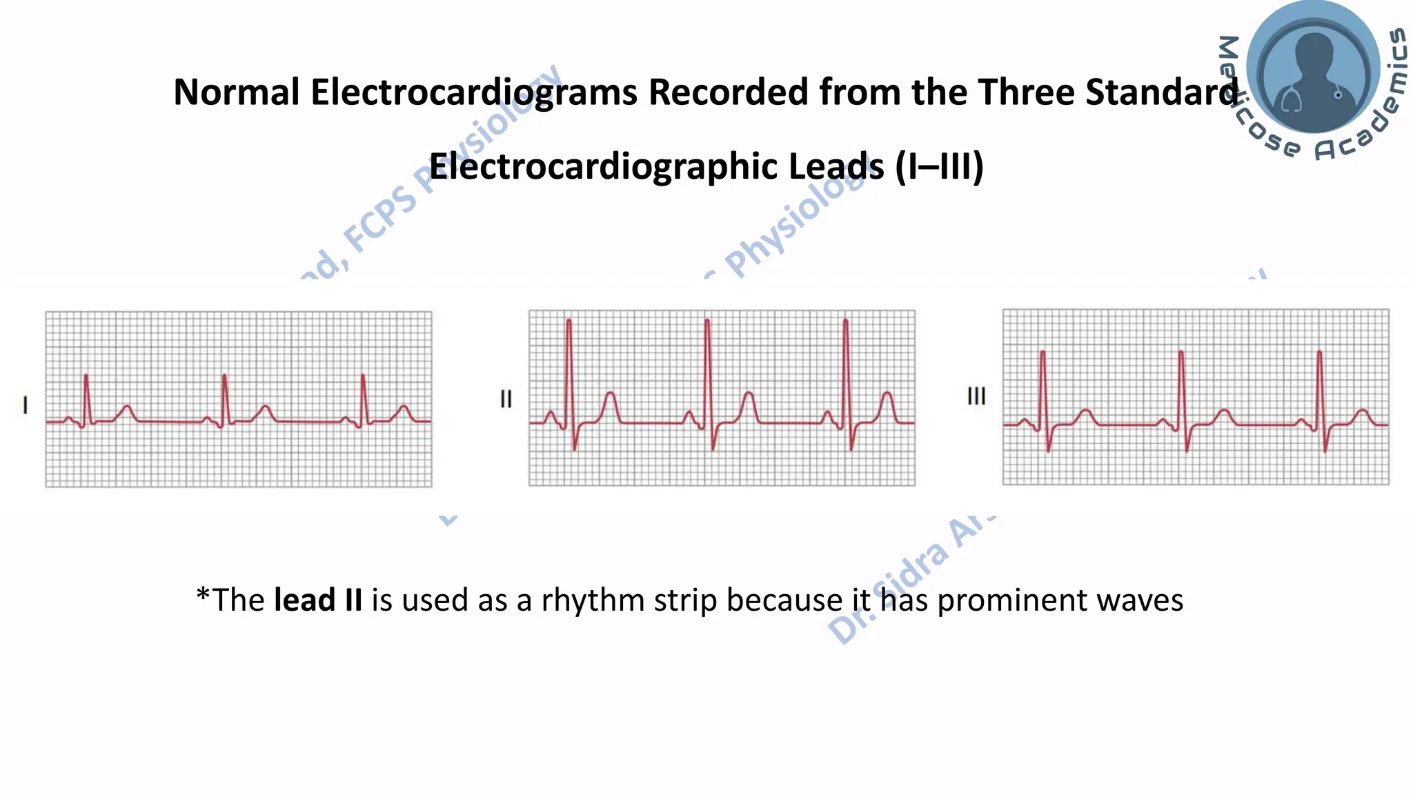 The Electrocardiogram - Physiologic Principles | PDF