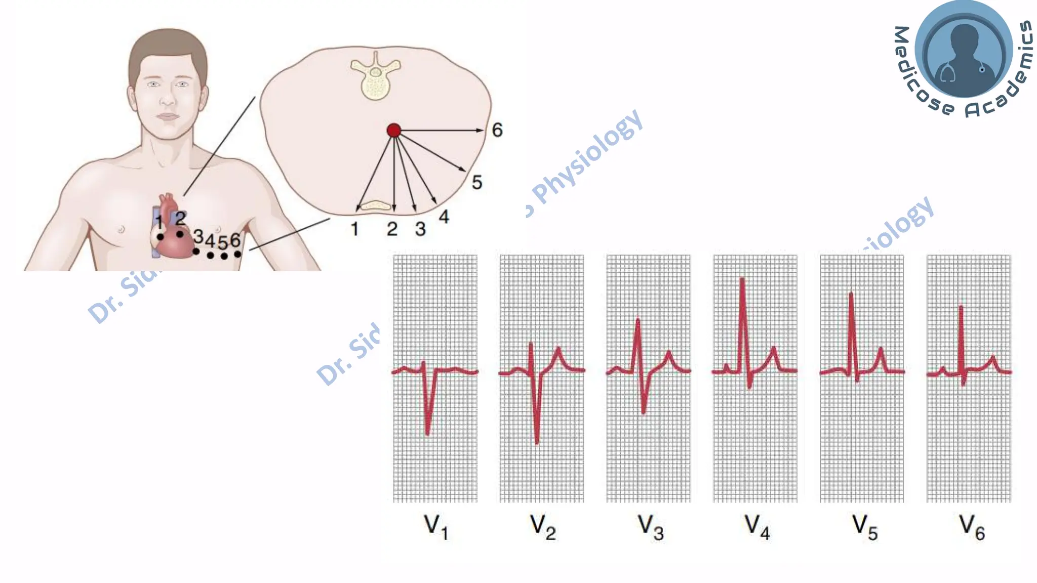 The Electrocardiogram - Physiologic Principles | PDF