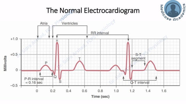 The Electrocardiogram - Physiologic Principles | PDF