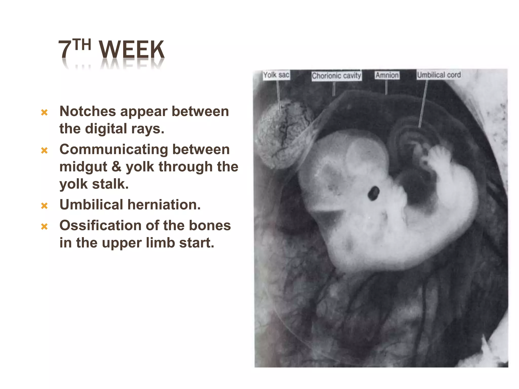 The_embryonic_(Organogenetic)_Period(3th_to_8th_weeks_).pptx