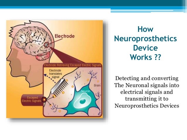 The Emerging World of Neuroprosthetics