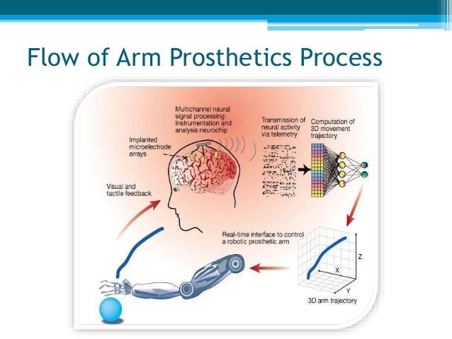 The Emerging World of Neuroprosthetics