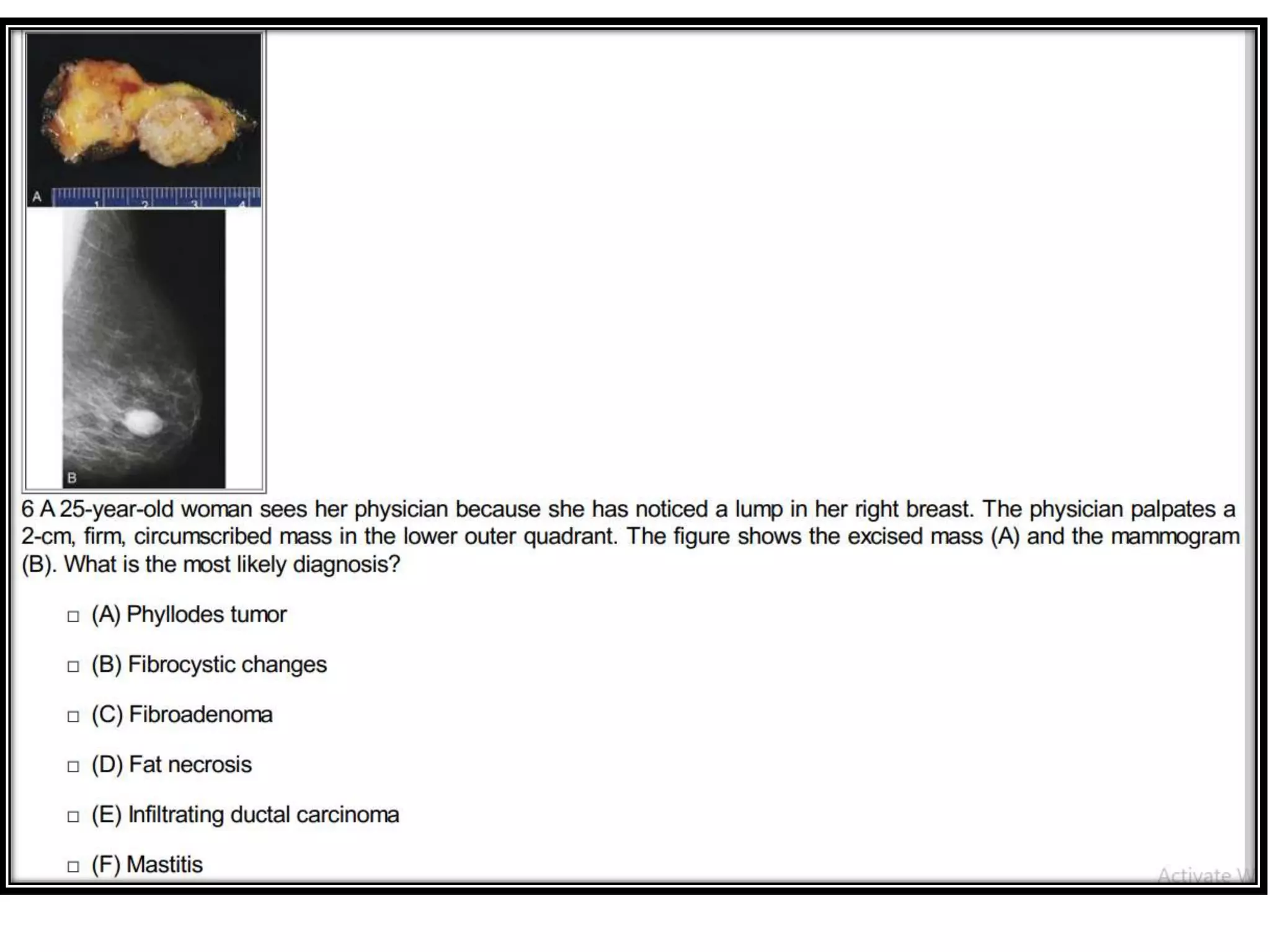 The Endocrine System Pathology | PPTX